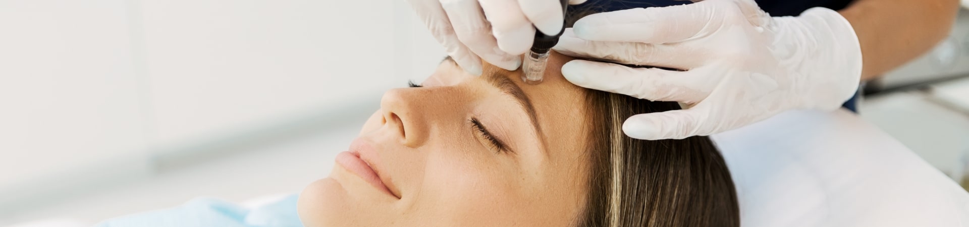 Genius RF Microneedling | Youthful Obsession